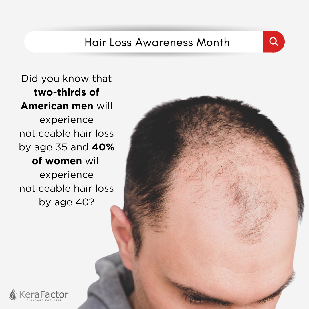 Transforming Perspectives: The Role of Hair Loss Awareness Month